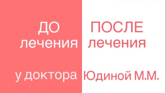 ДО и ПОСЛЕ ведения у доктора Юдиной М.М.