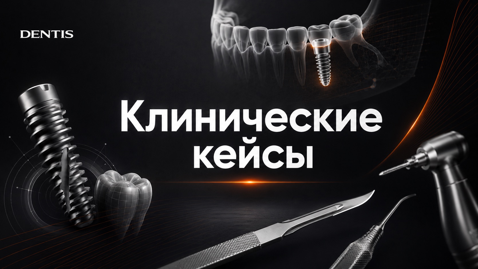 Кейсы