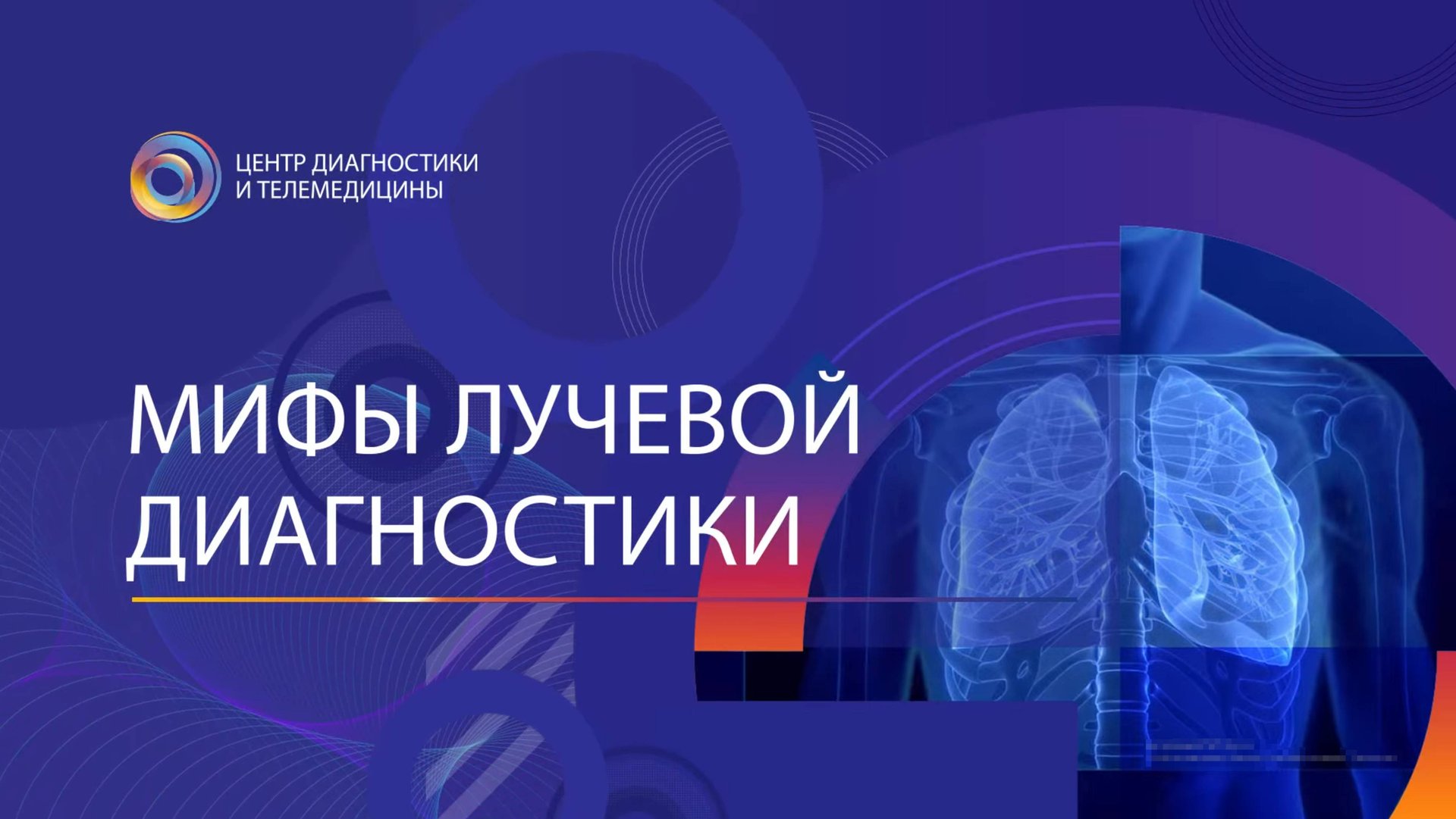 Мифы лучевой диагностики