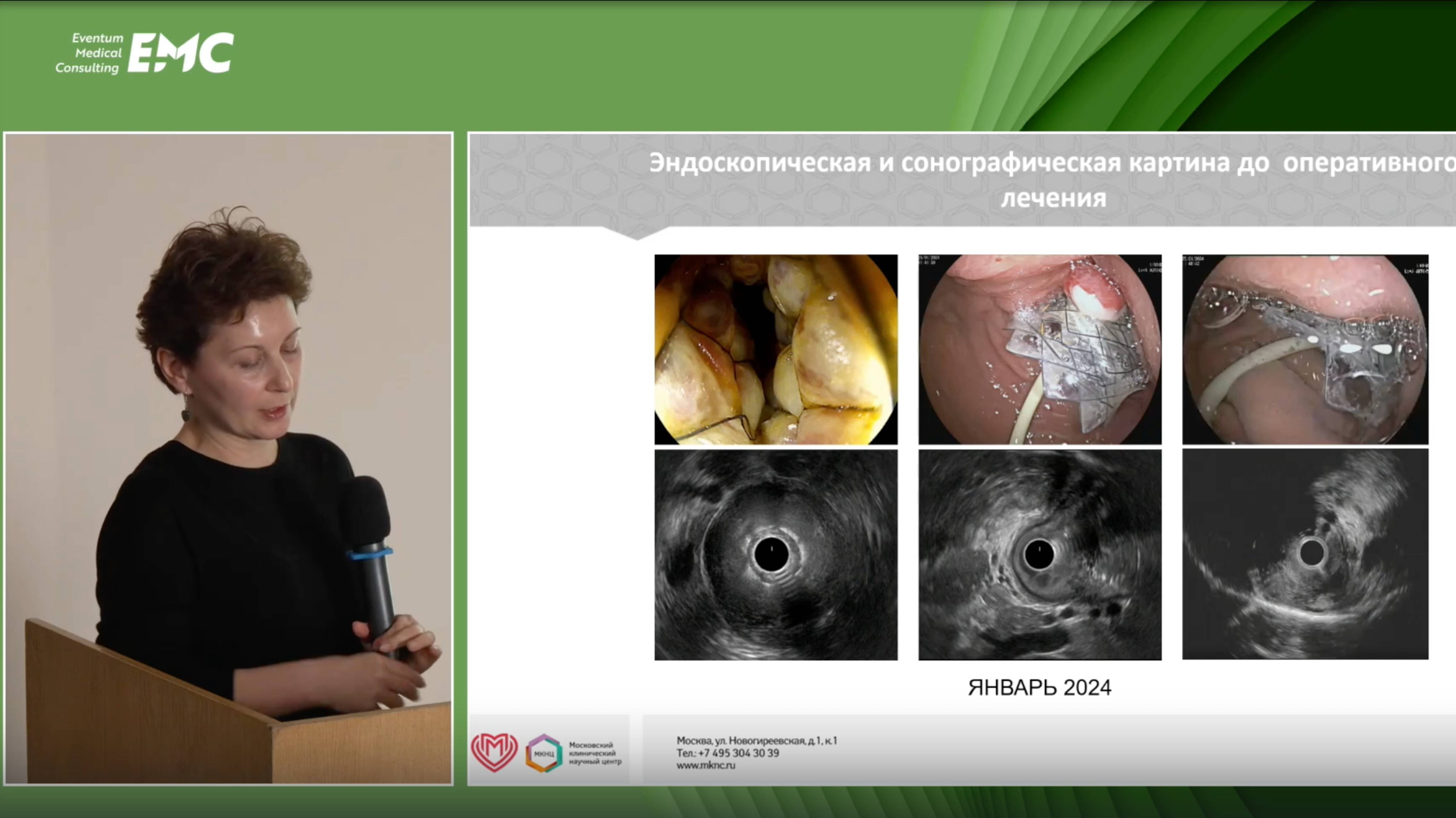Заседание №217 от 19.03.25