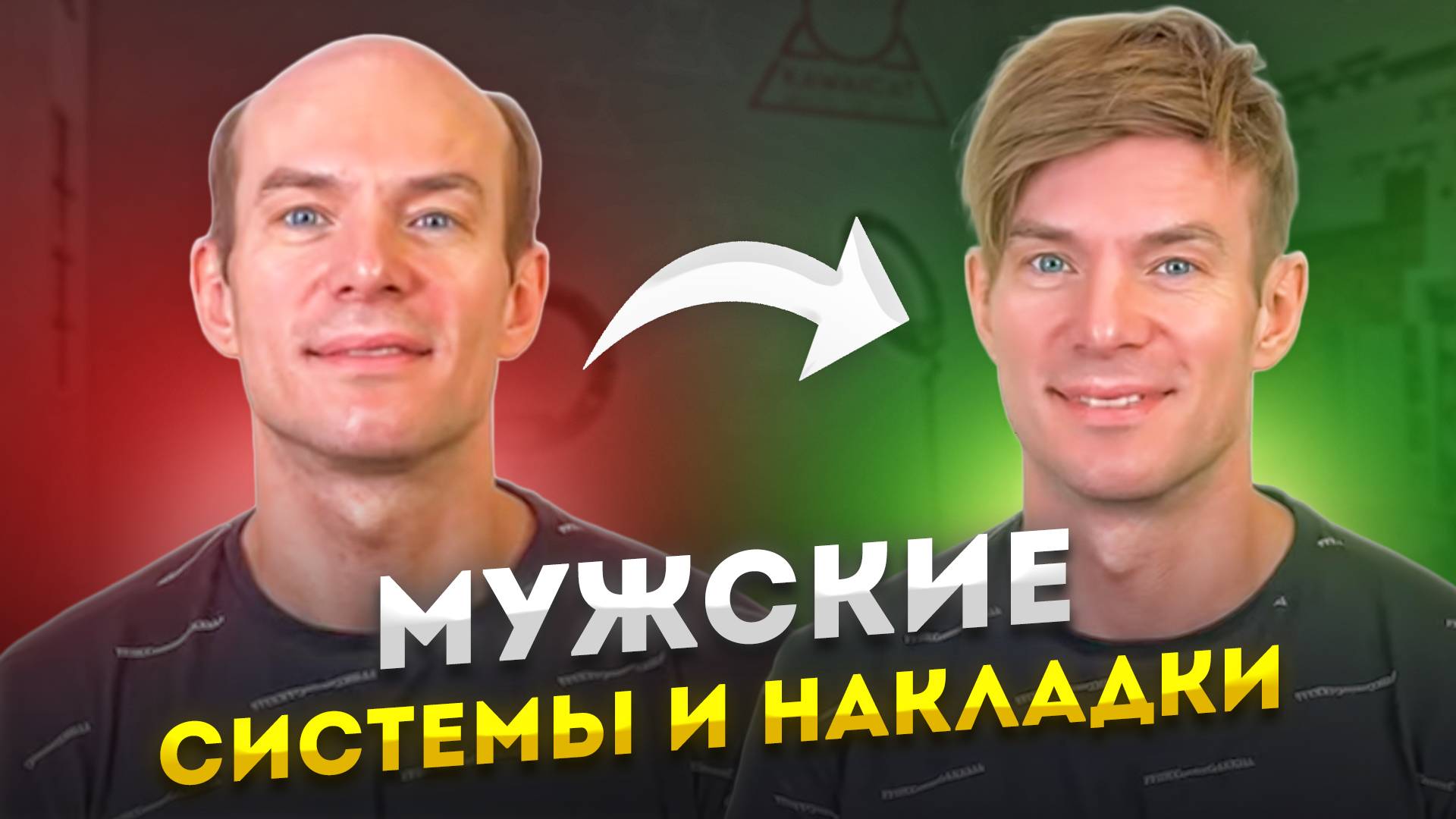 Мужские системы и накладки