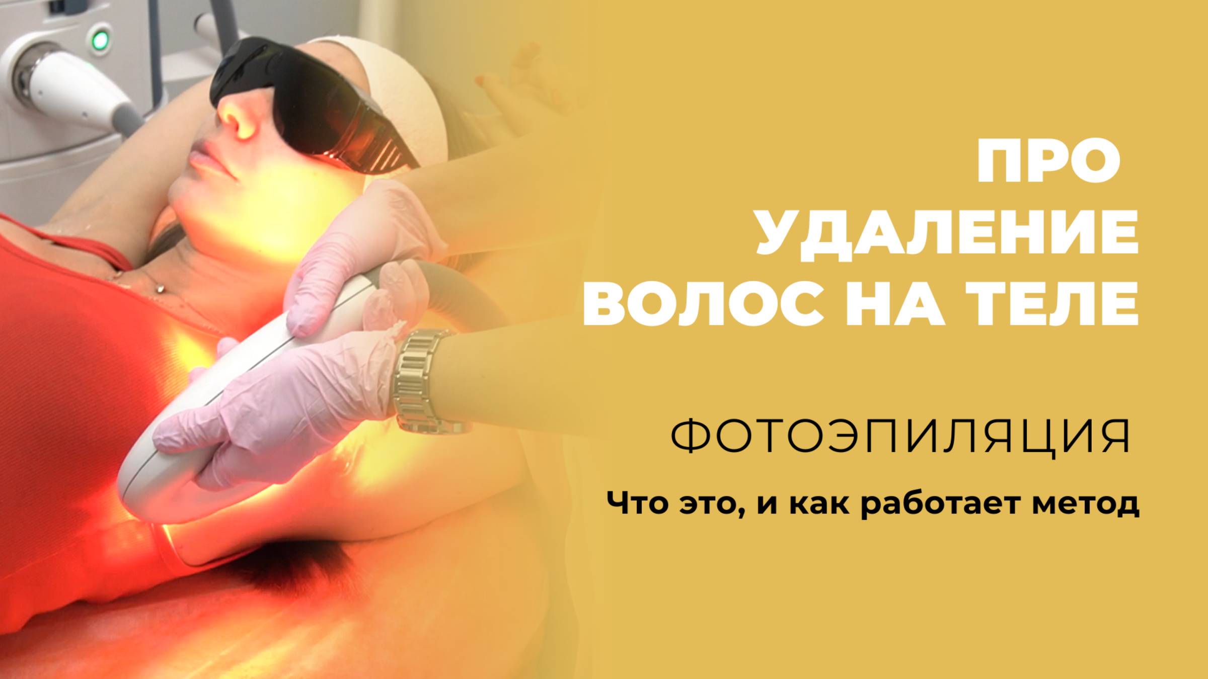 Фотоэпиляция