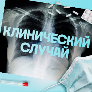 КЛИНИЧЕСКИЙ СЛУЧАЙ