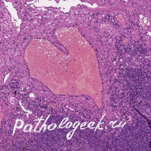 Иконка канала Pathologeek