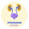 Иконка канала Уротелиальная карцинома