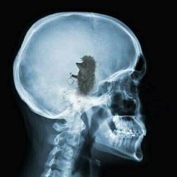 Иконка канала Ёж в тумане