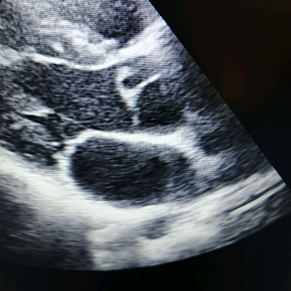 Иконка канала ЭКГ, Эхо и узи сосудов в работе кардиолога.