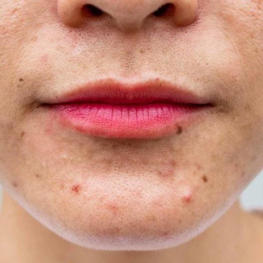 Иконка канала Истории кожи