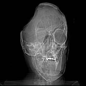 Иконка канала хроники одного восстановления