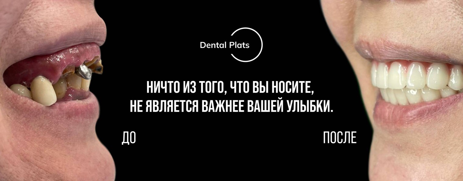 Стоматологический центр Dental Plats