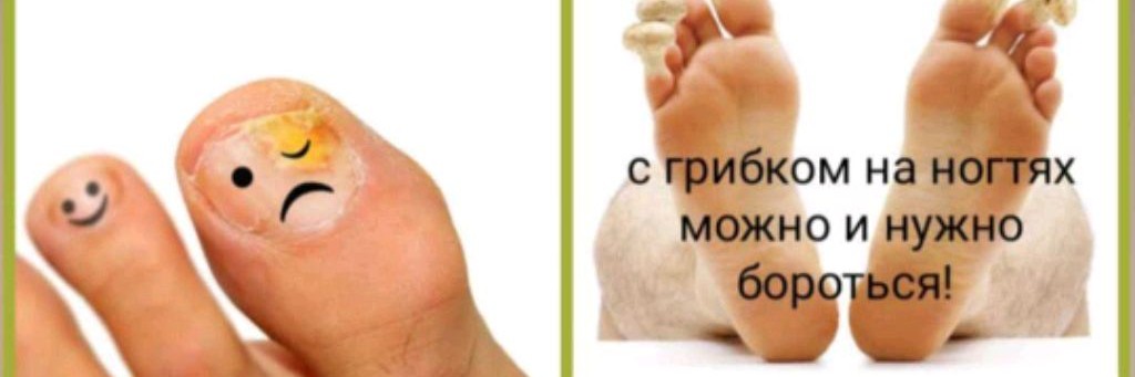 Ваши 👣 в надёжных 🤲