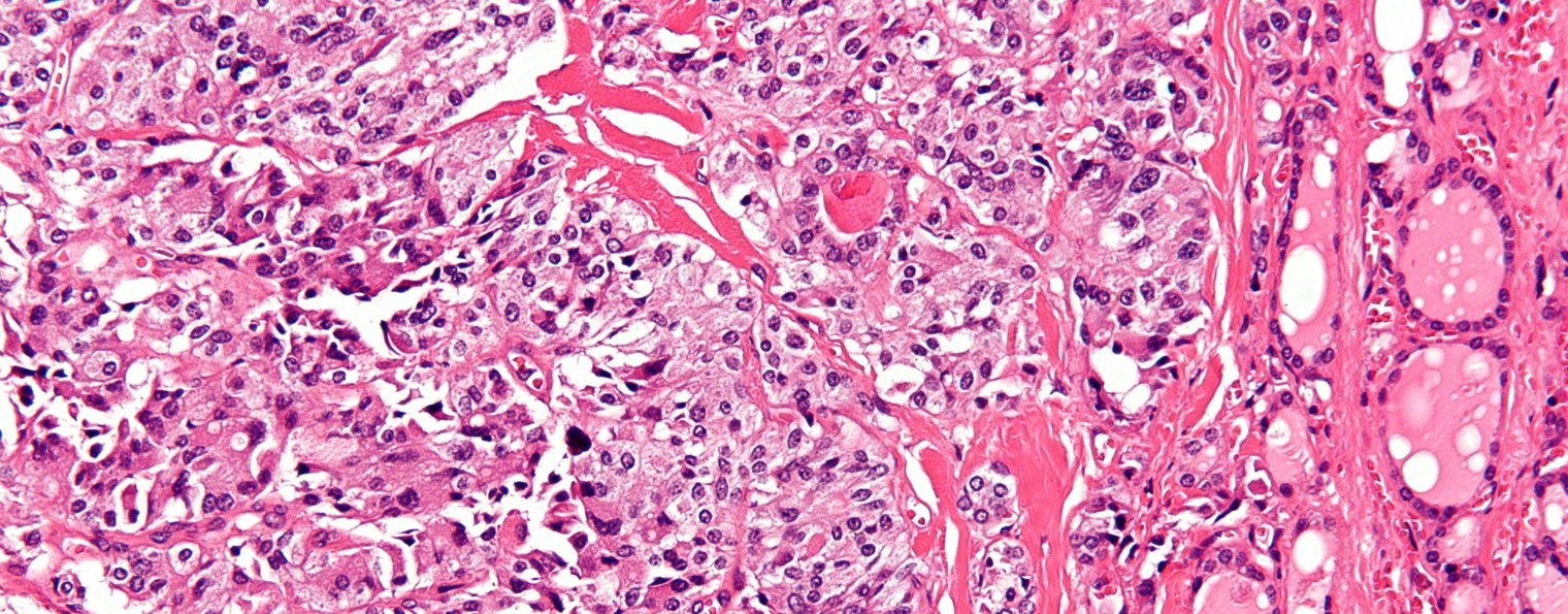 Вокруг Патологии