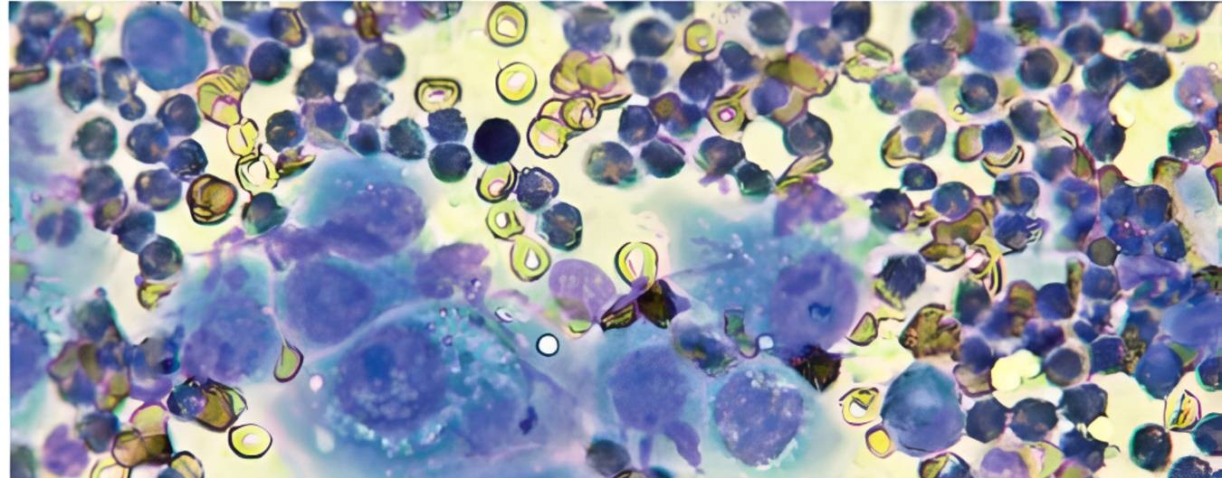 ЭНДОМИР - фонд помощи и развития