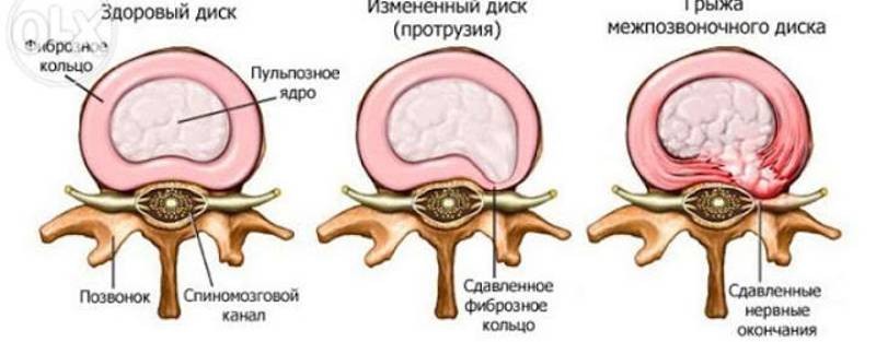 Рамазанова Ирада