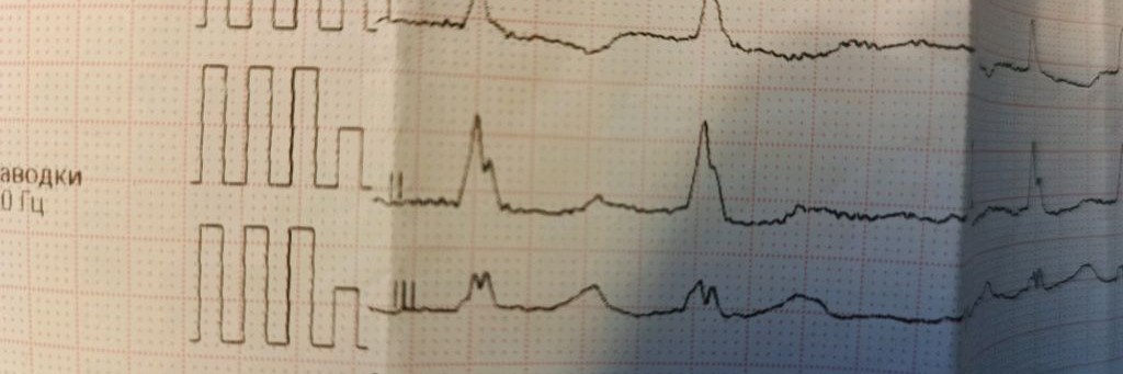 ЭКГ, Эхо и узи сосудов в работе кардиолога.