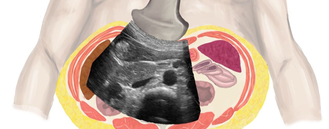 Кириллова Маргарита Сергеевна - канал об УЗД