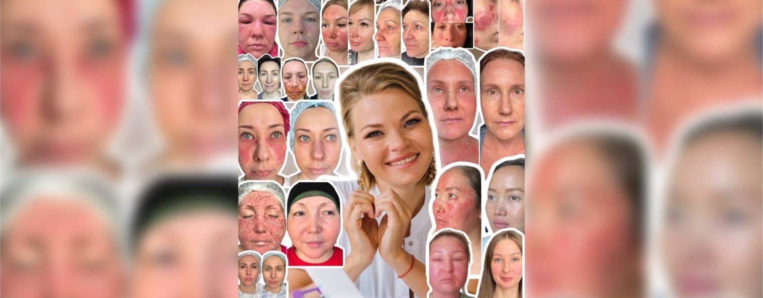 Перевалова Е.Г про лечение розацеа и здоровье кожи