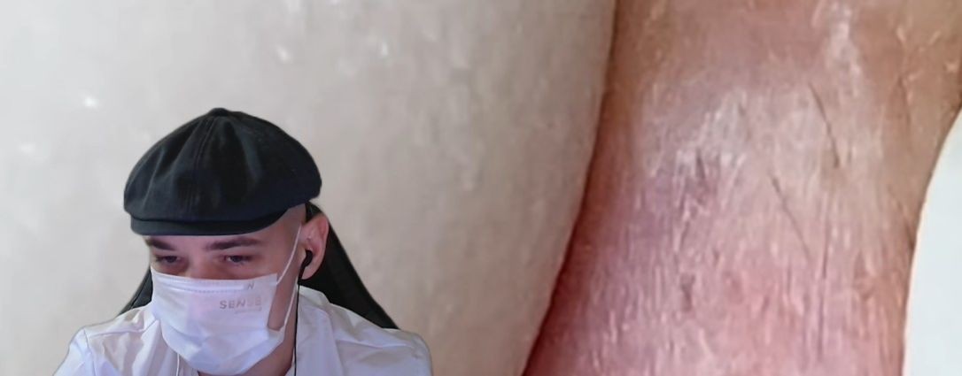 Прыщевая Вселенная