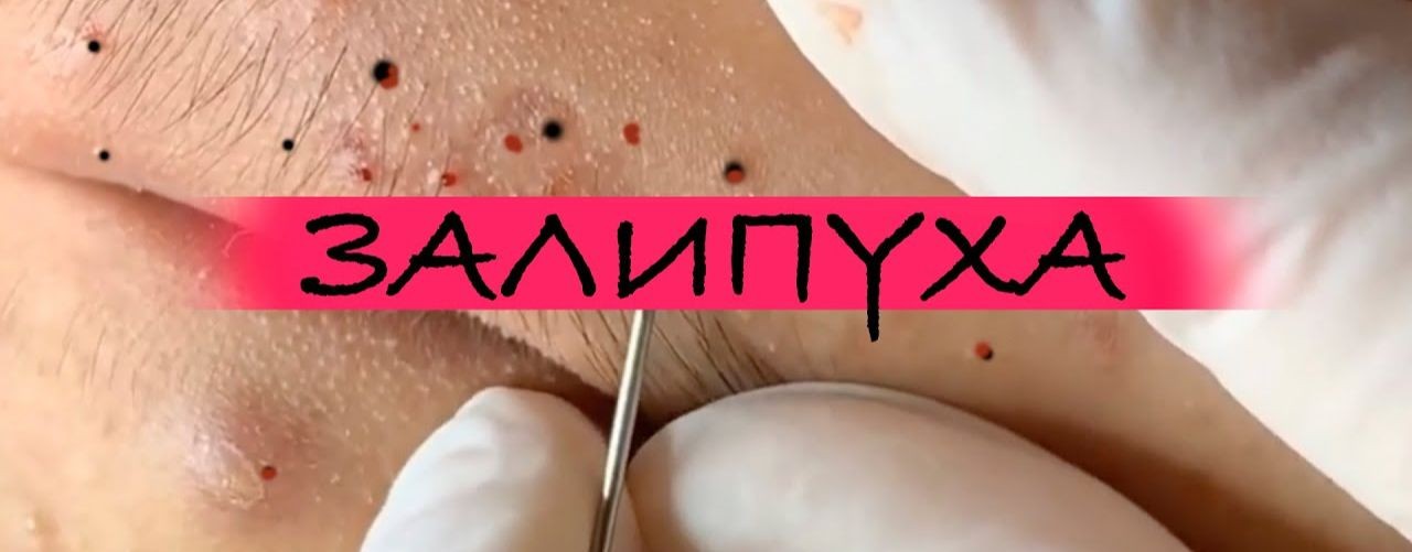 ЗАЛИПУХА | ДАВИМ ПРЫЩИ И УГРИ