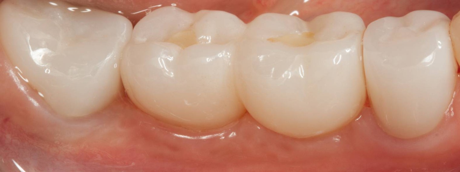 Имплантариум Implantarium