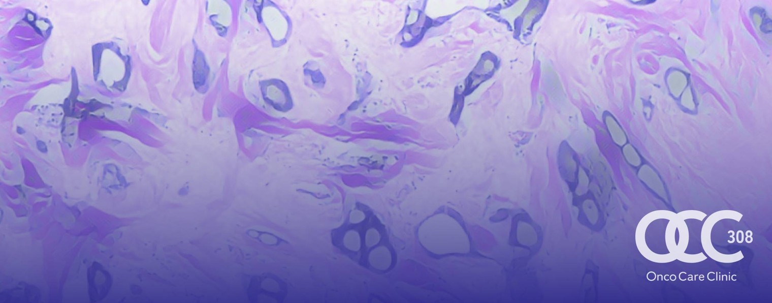 Клиника цитокинотерапии OncoCareClinic 308