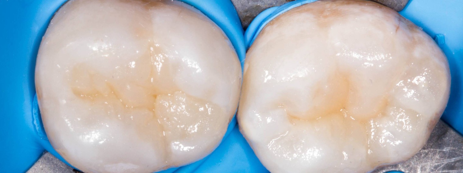 Дневник Дантиста ( Сурайкин Илья )