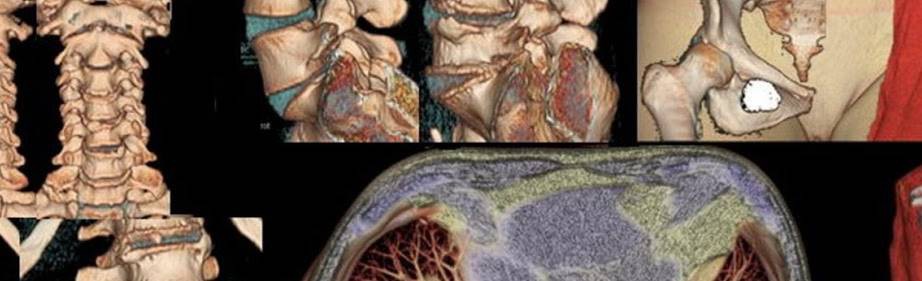 Секреты лучевой диагностики