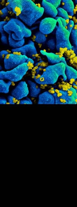 Риски и пути заражения ВИЧ