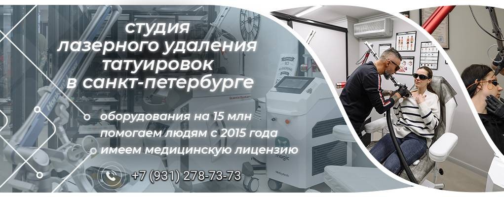 УДАЛЕНИЕ ТАТУИРОВОК И ТАТУАЖА