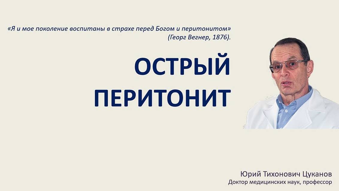 Острый перитонит: классика и современность. Лекция для врачей.