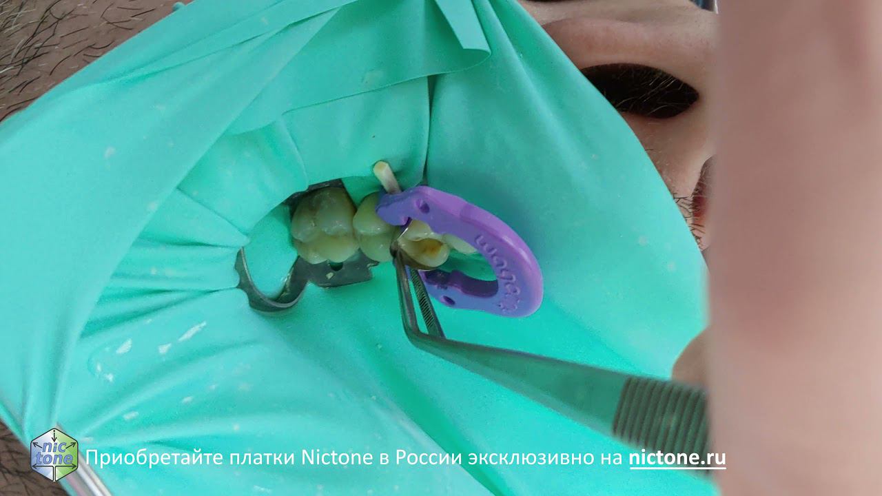 Dental Therapy Grand Cource — Wagotrix