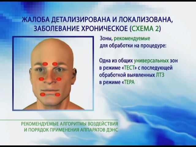 Алгоритмы воздействия аппаратами ДЭНАС