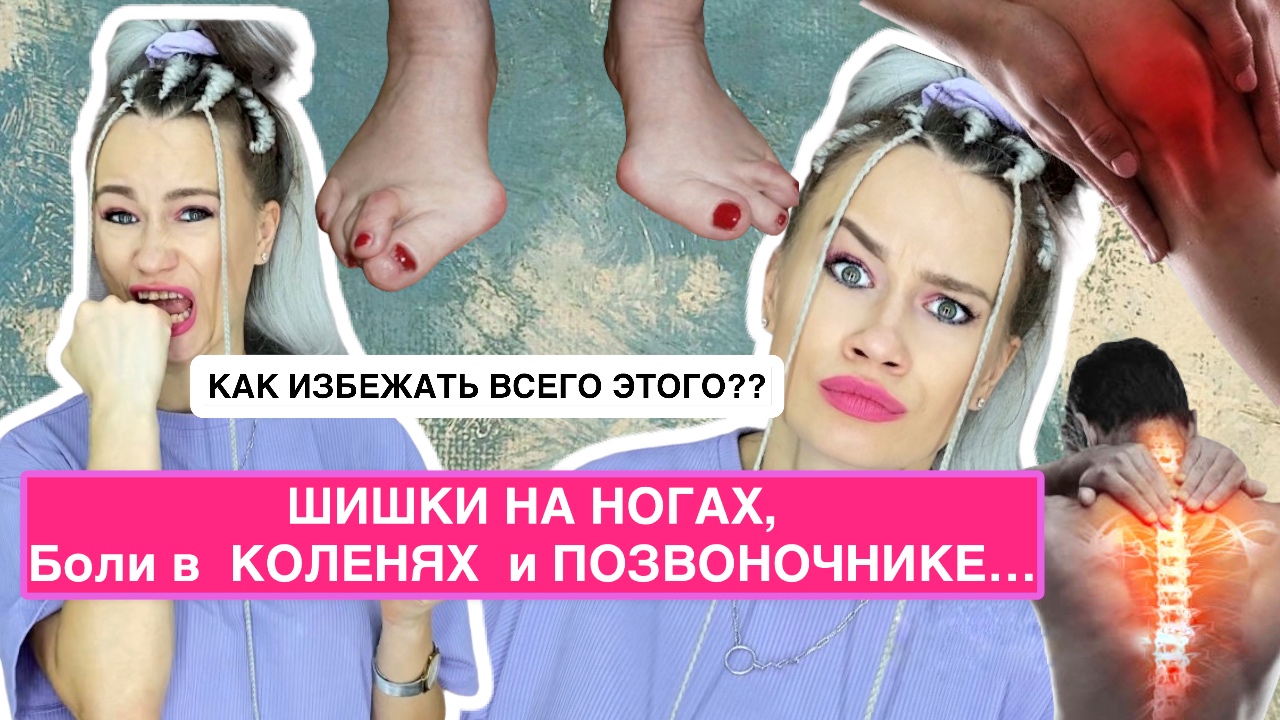 Шишки на ногах, боль в коленях и пояснице - как избежать всего этого??!Канал АлизеБлина