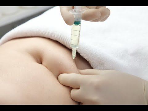 СОП. Инъекции инсулина