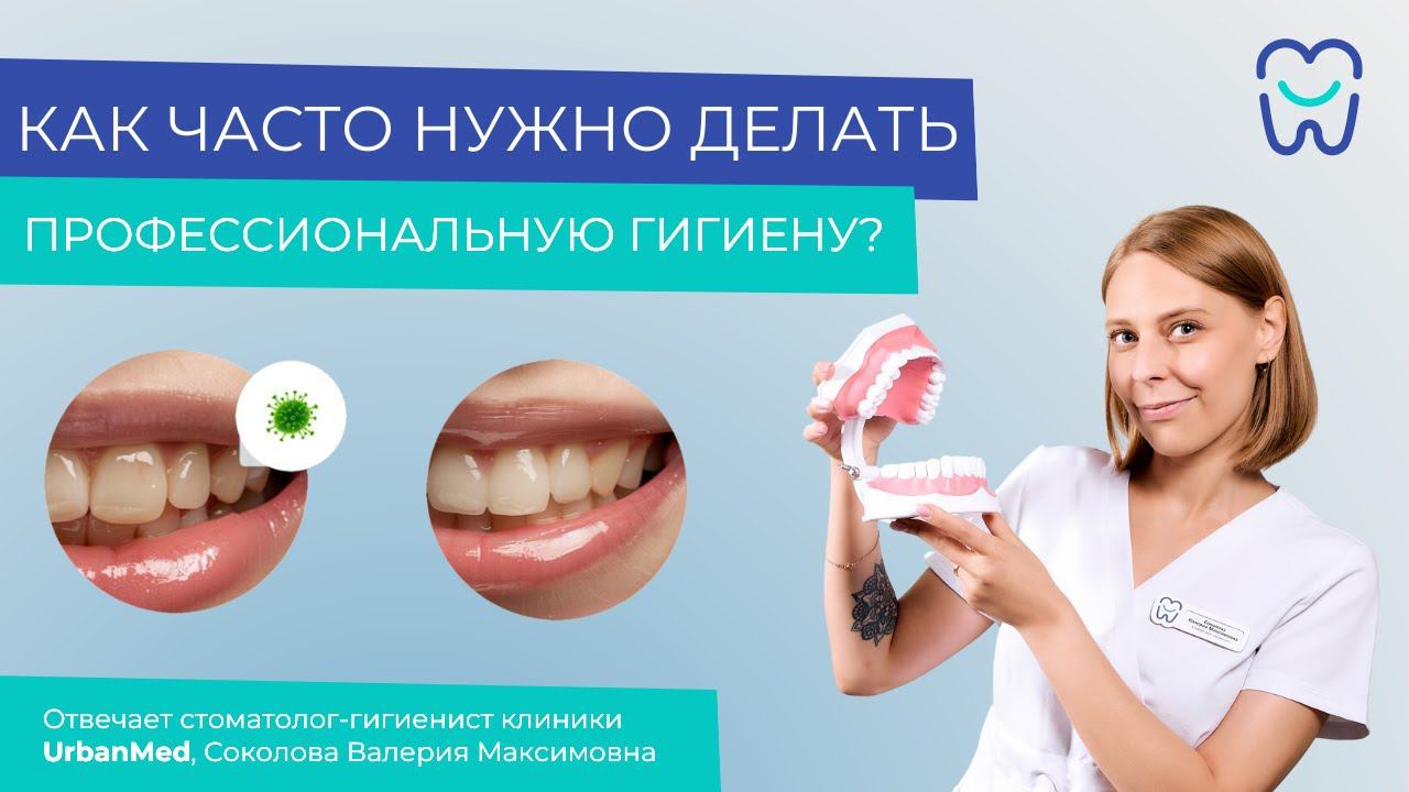 Как часто нужно делать профессиональную гигиену?