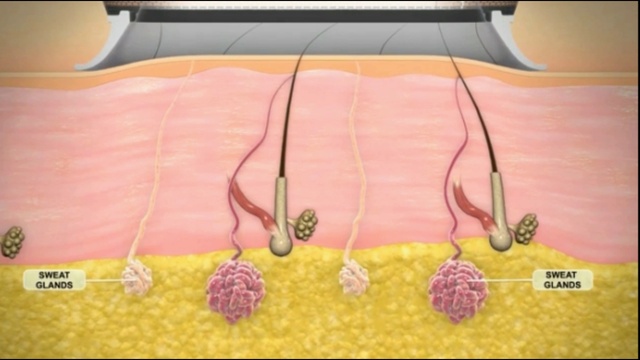 Miradry, оригинальный видеоролик