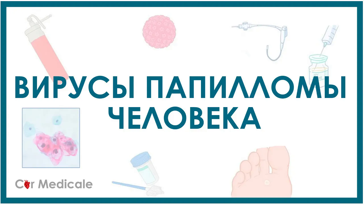 Вирусы папилломы человека - клинические проявления, диагностика, профилактика, лечение