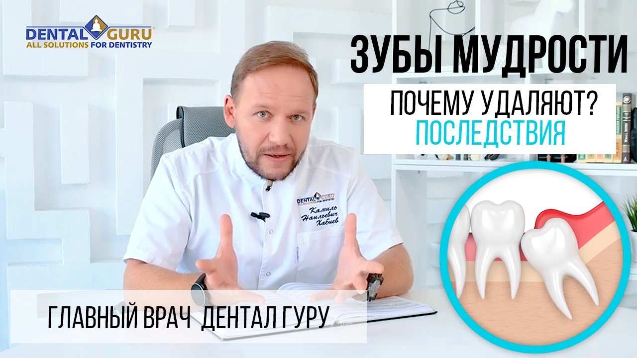 Почему удаляют зубы мудрости?