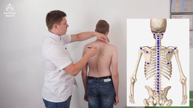 Часть диагностики позвоночника и суставов перед Правкой. Это можно сделать самостоятельно дома.
