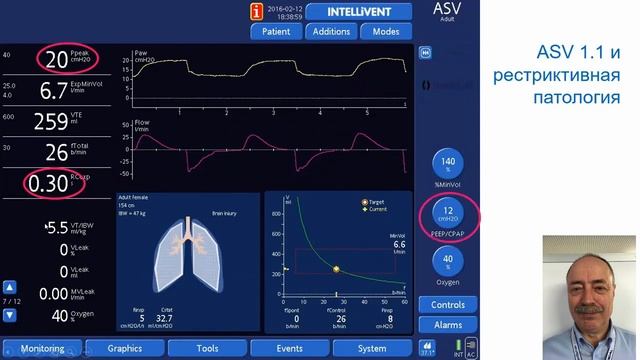 ИВЛ при рестриктивной патологии легких 2020 Сатишур О.Е
