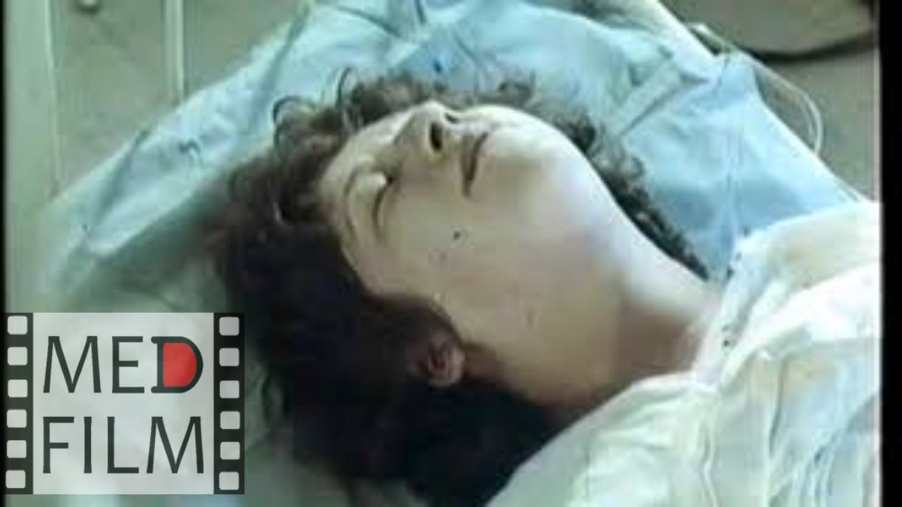 Роды при чистом ягодичном предлежании, проф. Ванина Л.В. © Breech presentation