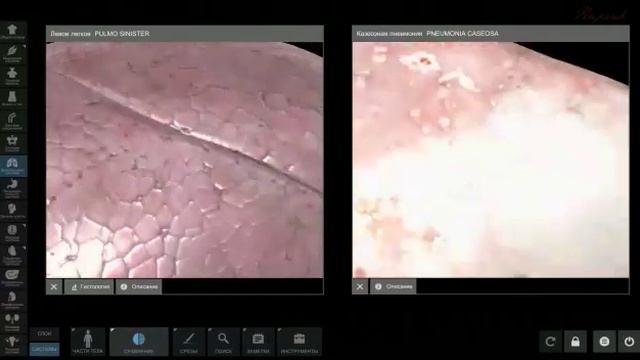 Остановим короновирус вместе