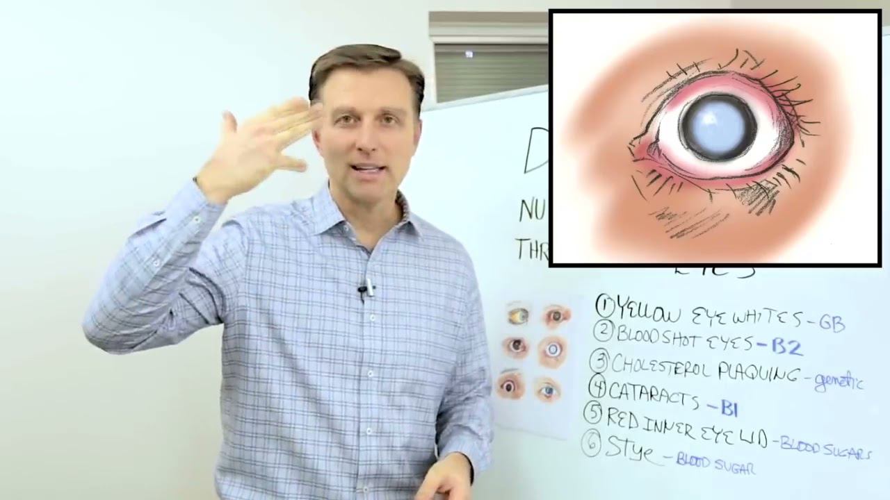 Как по глазам определить проблему по здоровью