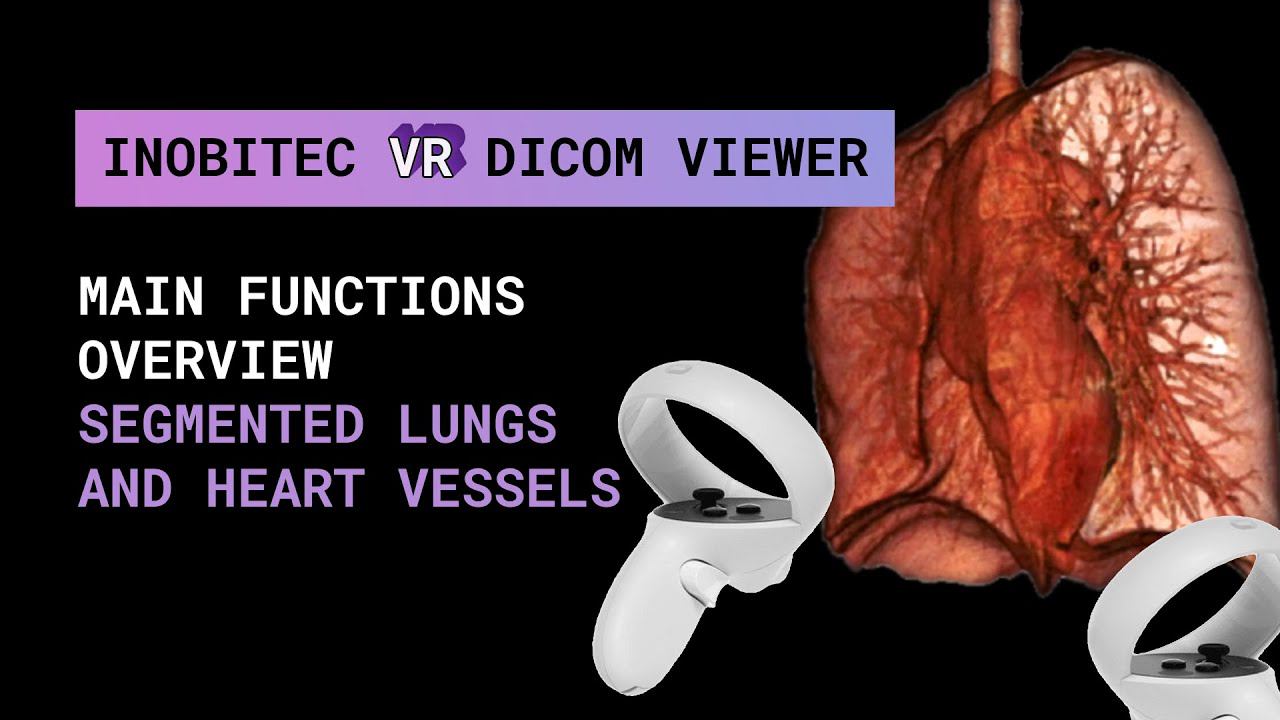 Обзор функциональности программы Inobitec VR DICOM Viewer. Сегментация легких и сосудов сердца