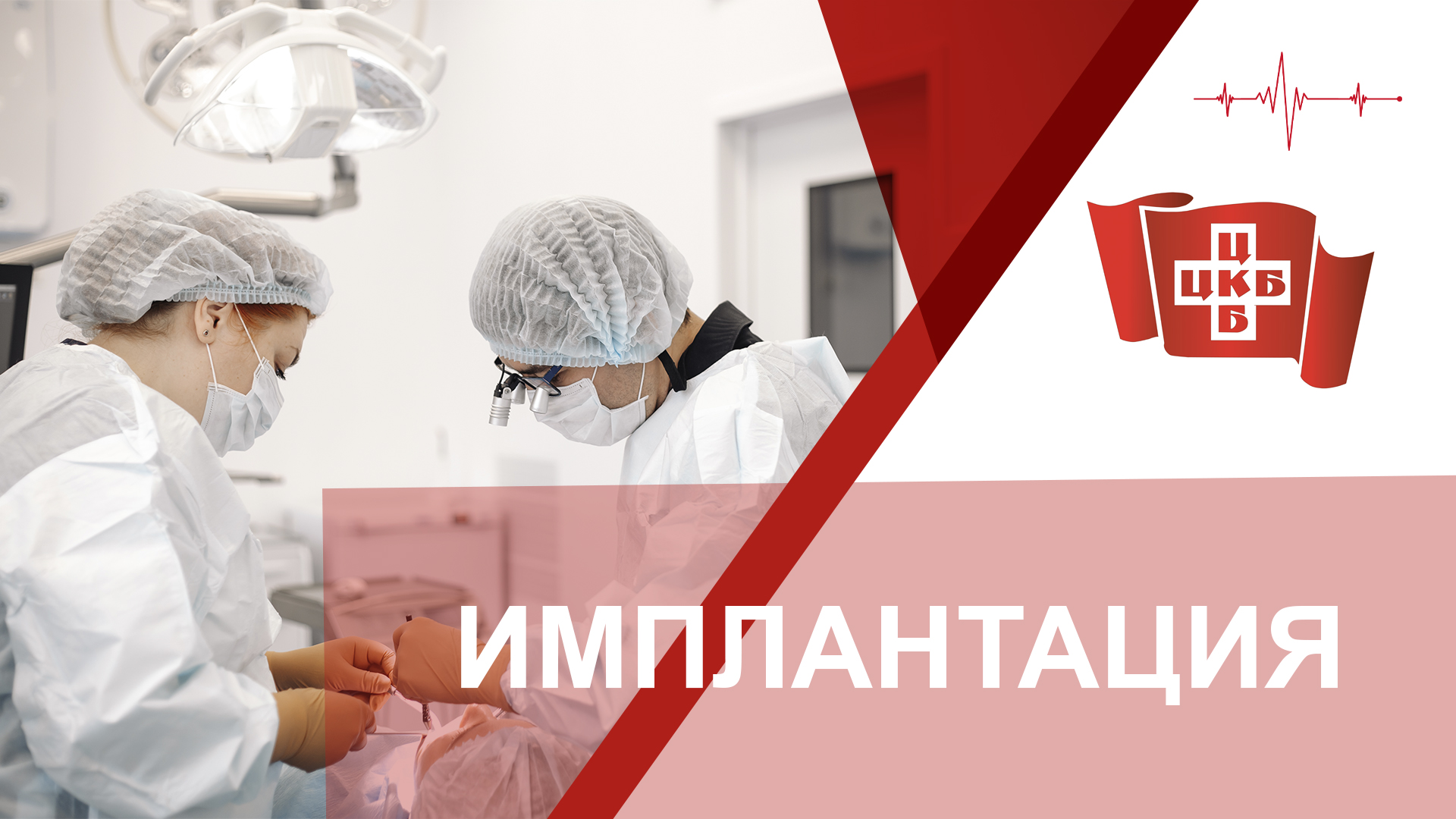 Имплантация зубов