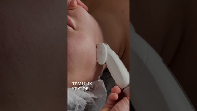 Эндермолифт (LPG) - anti-age уход за лицом