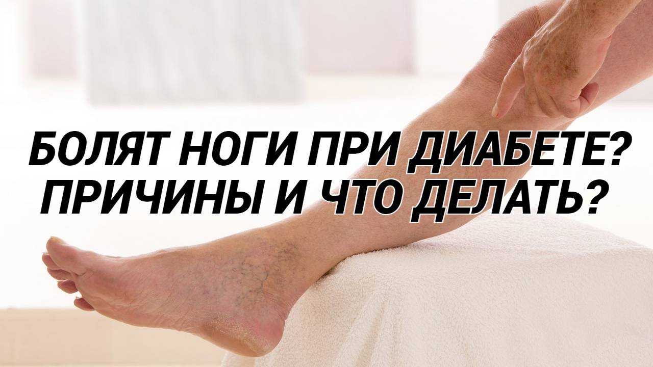 Болят ноги при сахарном диабете: причины и лечение! Полинейропатия, диабетическая стопа!