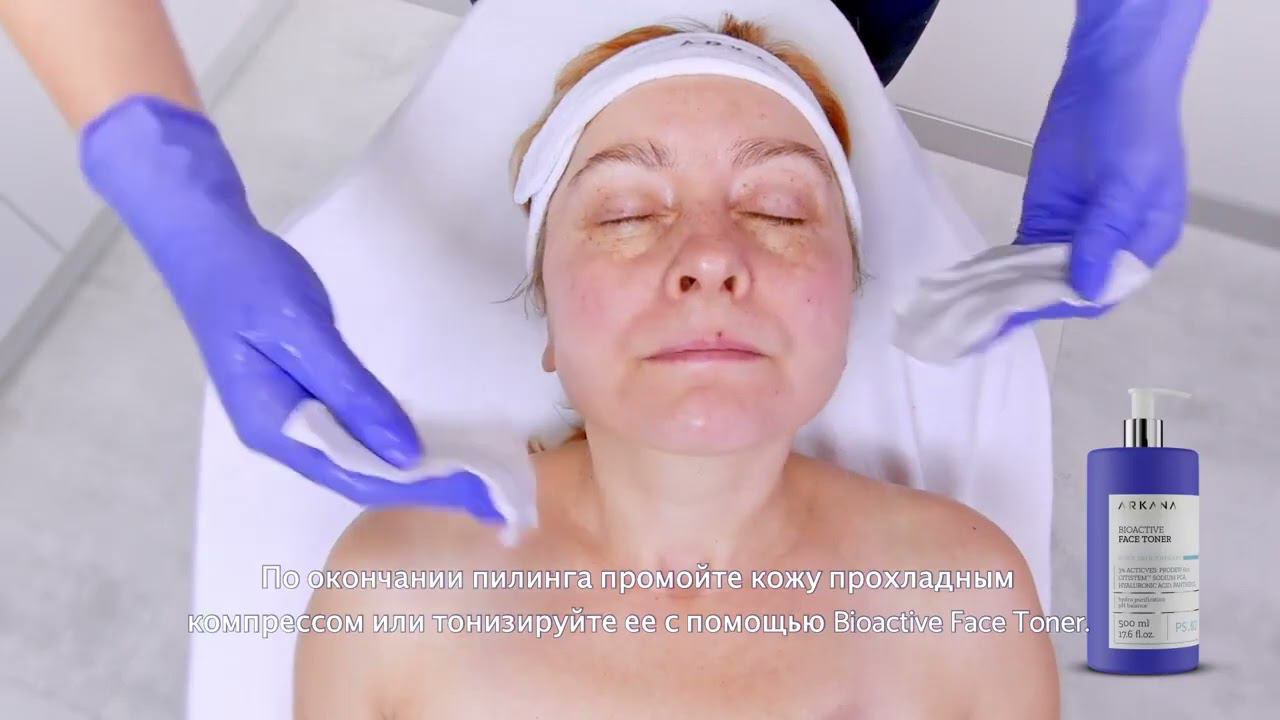 H Active Peel   водородный пилинг