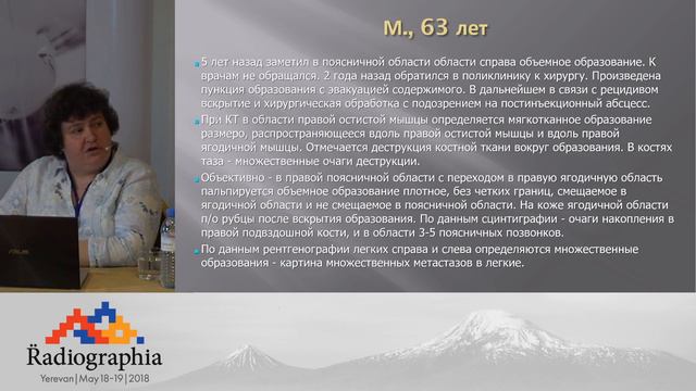Интерактивное обсуждение случаев костной онкологии. Татьяна Павленко