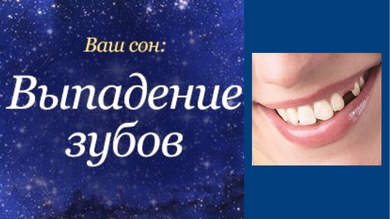 Сонник( выпадают зубы). Толкование снов. Если вам приснился сон, в котором у вас выпадают зубы.